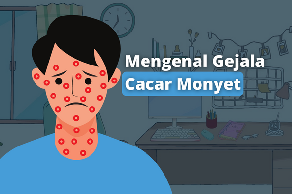 Kata Kemenkes Mengenai kasus Cacar Monyet : Penularan, Gejala dan Tanda ...