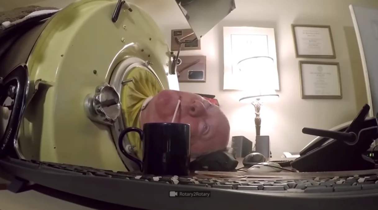 Paul Alexander: Pria Paru-paru Besi Meninggal Dunia di Usia 78 Tahun ...